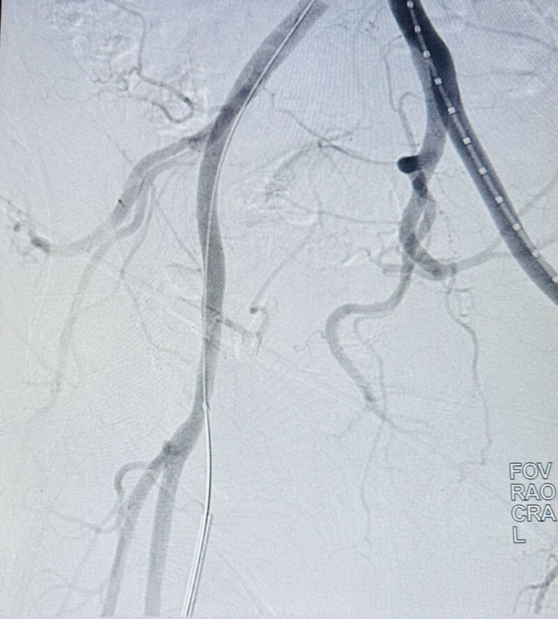 Cardivasocular Procedures – Houston Heart Care